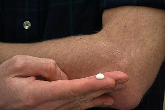 Winter Itch | Vanicream