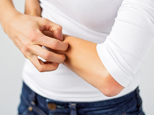 Why is My Skin Itchy? - Pharmaceutical Specialties, Inc.